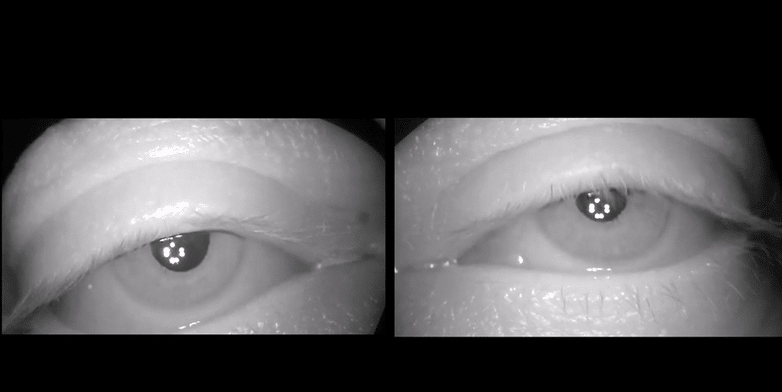 The Saccade Explained: Decoding the Eye Movements You See at the Bedside