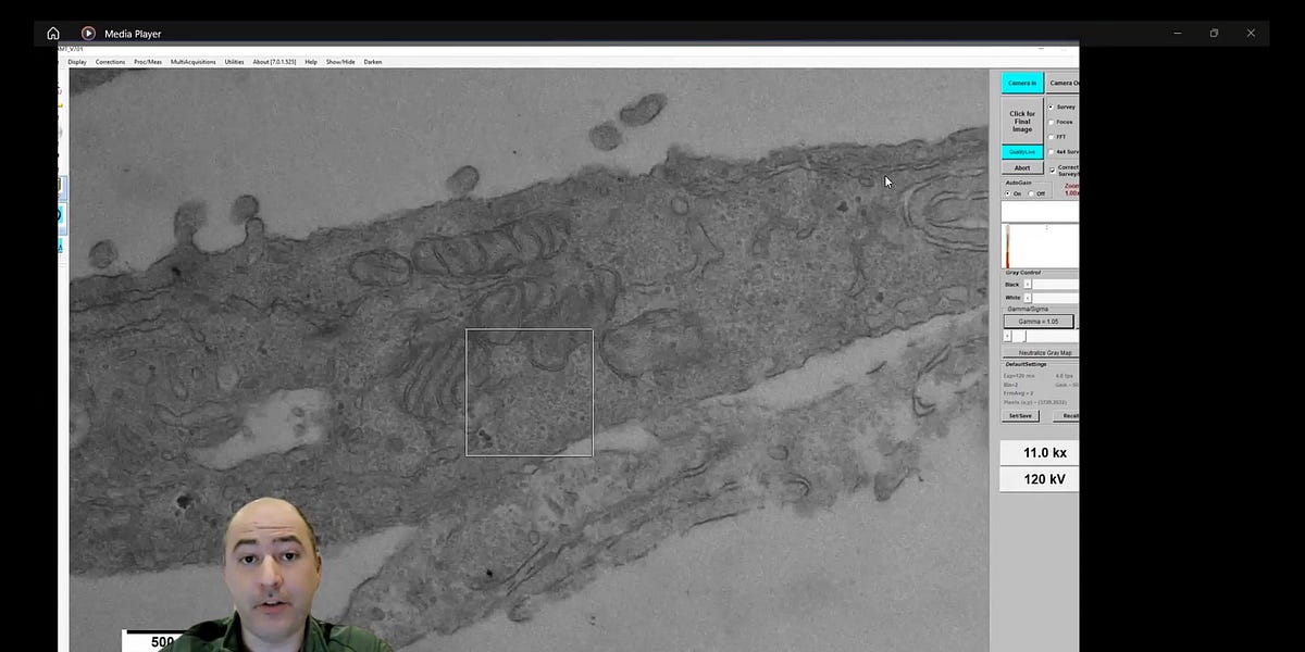 Walk through of Live Vero Cell Culture Microscopy