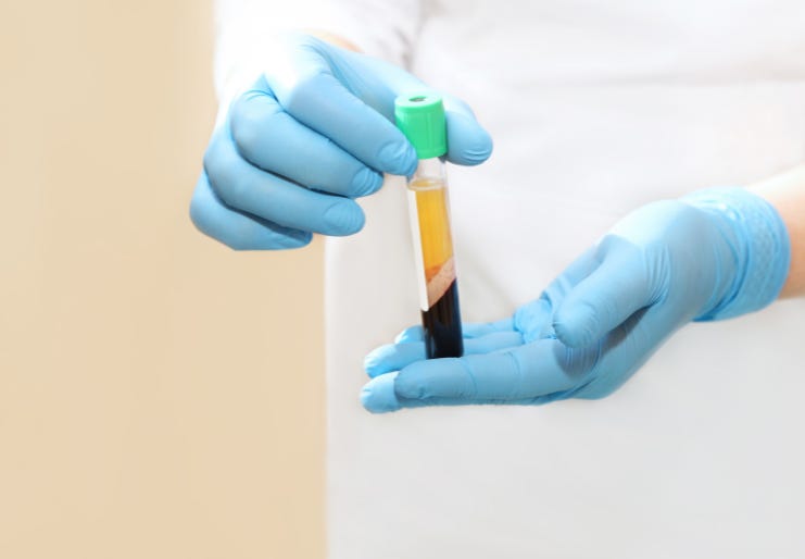The Order of Draw Series: Part Four - Heparin Tubes