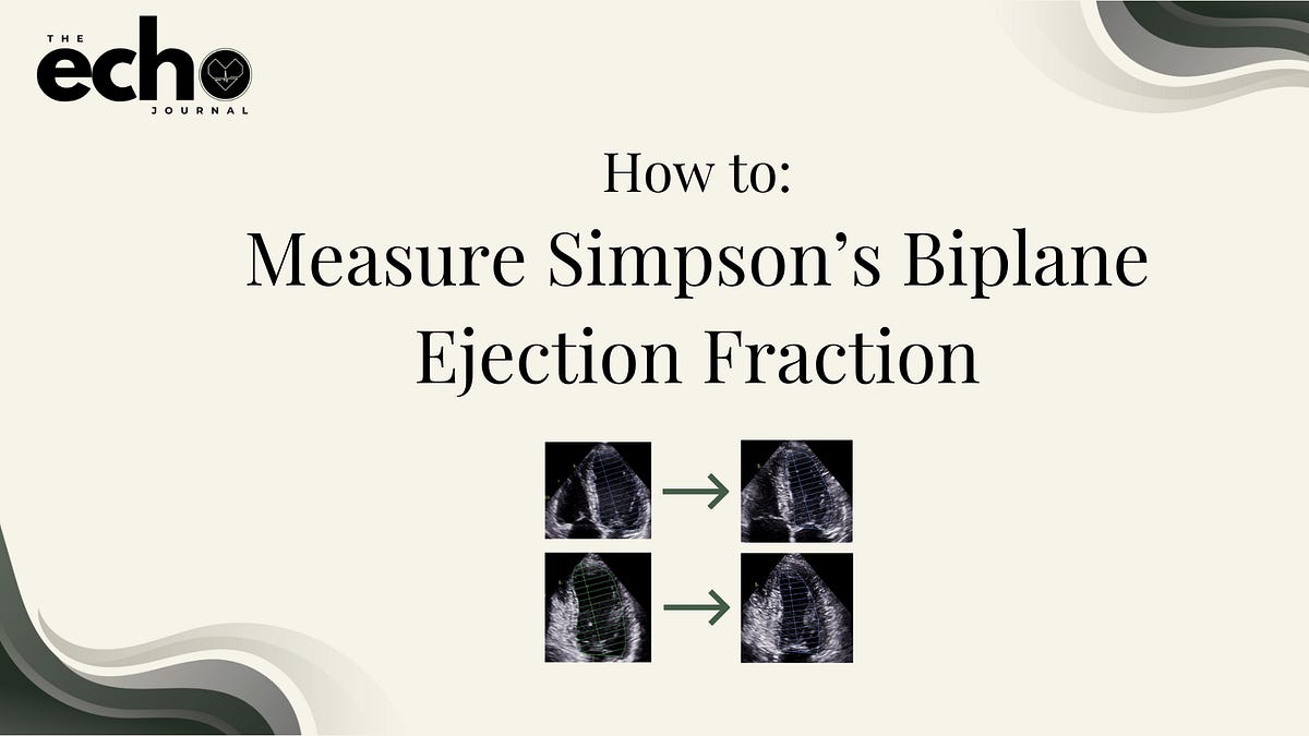 How To: Measure Simpson's Biplane Accurately - by Aram K.