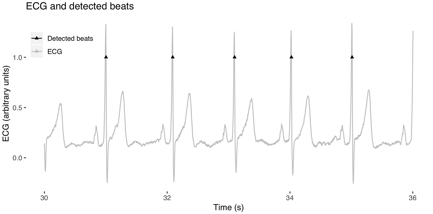 The Ultimate Guide to Heart Rate Variability (HRV): Part One