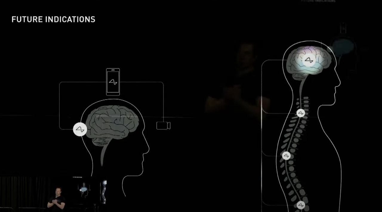 All Things Neuralink - Network