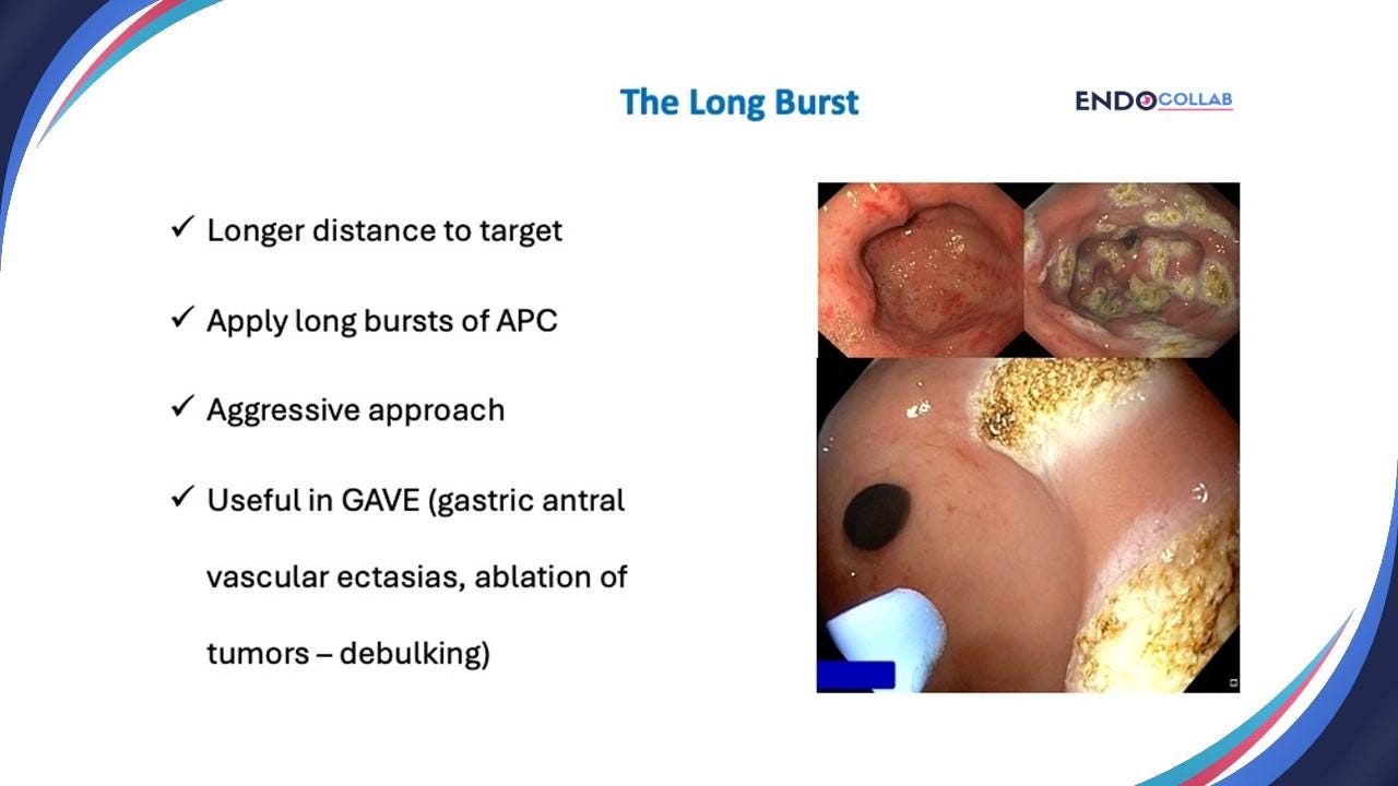 Six Top Tips to Use Argon Plasma Coagulation When Treating ...