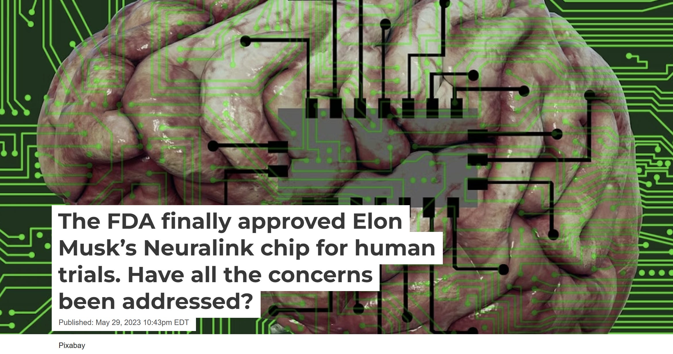 Musk announced, "Brain Chips to the Masses in 2026"