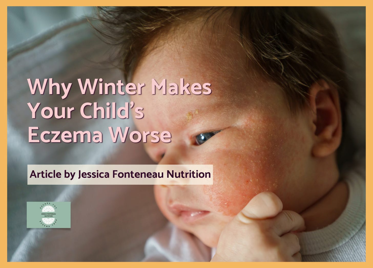 Why Winter Makes Your Child’s Eczema Worse
