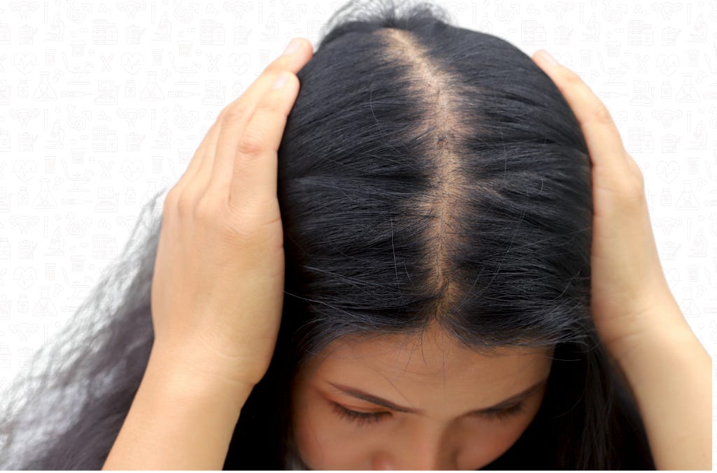 Menopause and Hair Loss: What’s Really Happening After 40