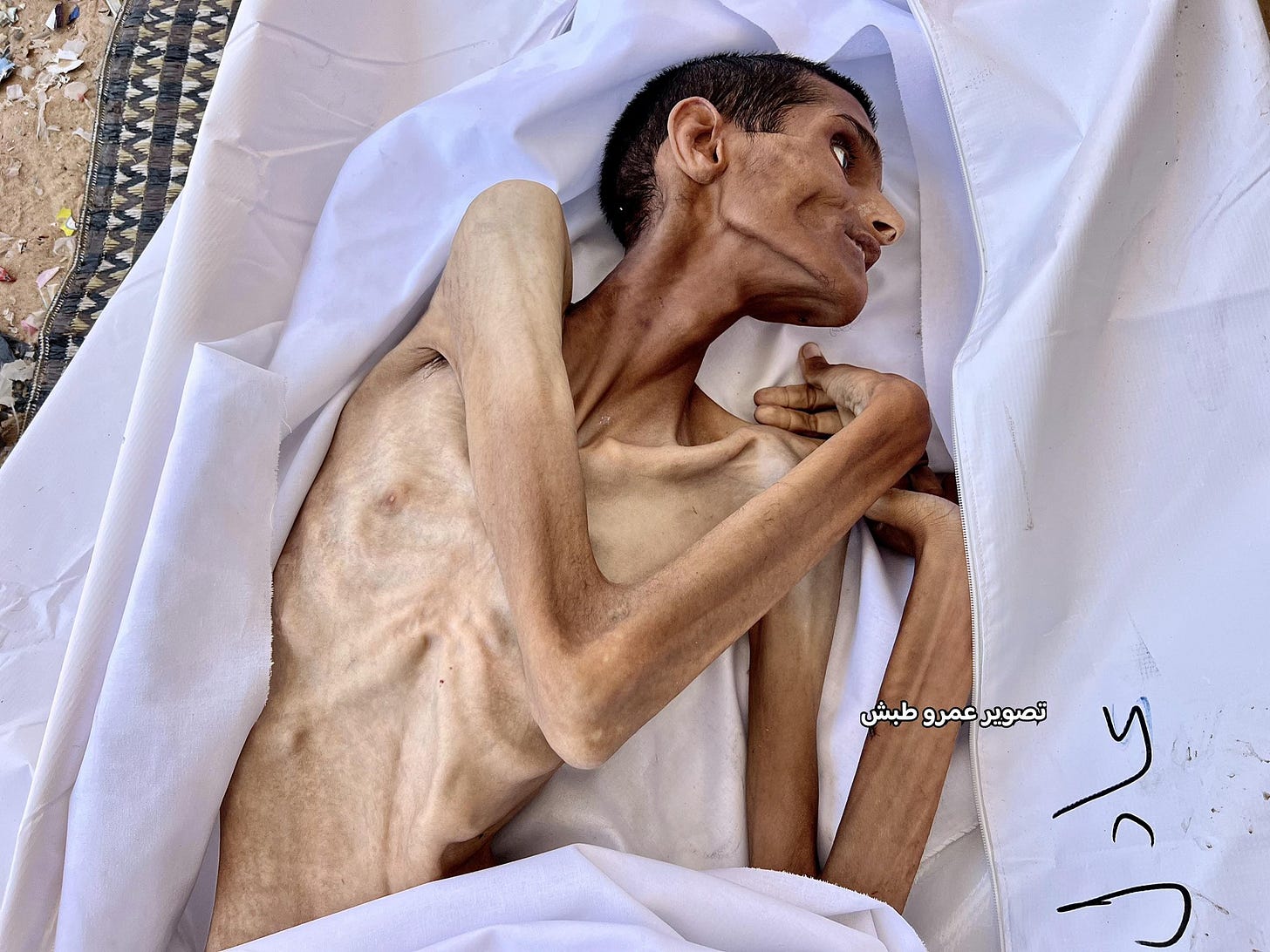 🕊️ Adel Madi Was Starved to Death in Gaza Today. He Was 27 Years Old.