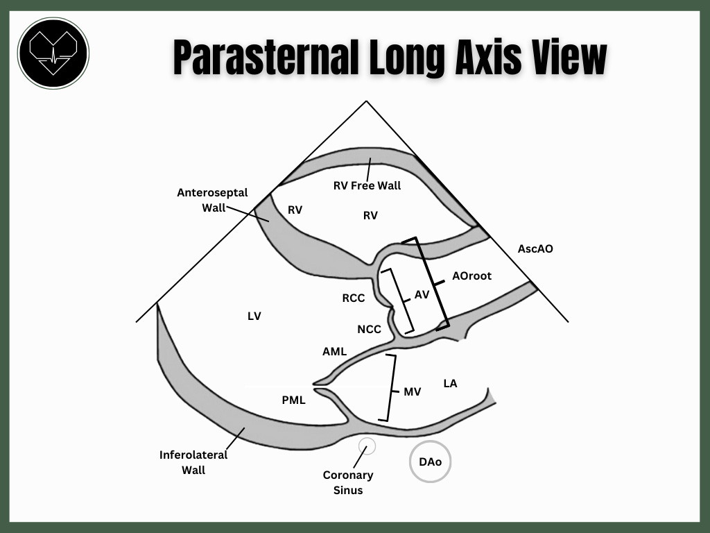 How To Get A Parasternal Long Axis Image - by Aram K.