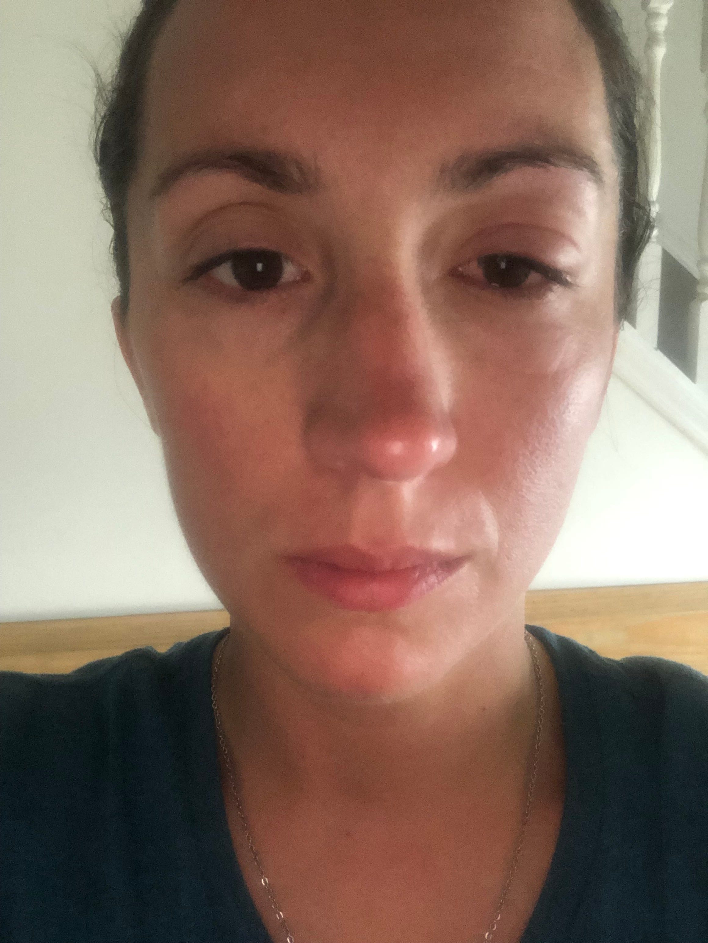 ☕ How I Naturally Healed POTS + MCAS (When the Doctor Told Me I Couldn’t)