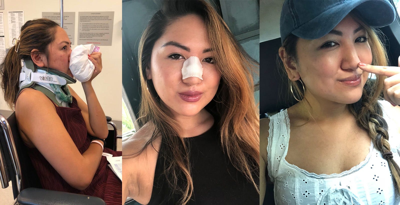 Learning to Love My Filipino Nose - by Kristina Rodulfo