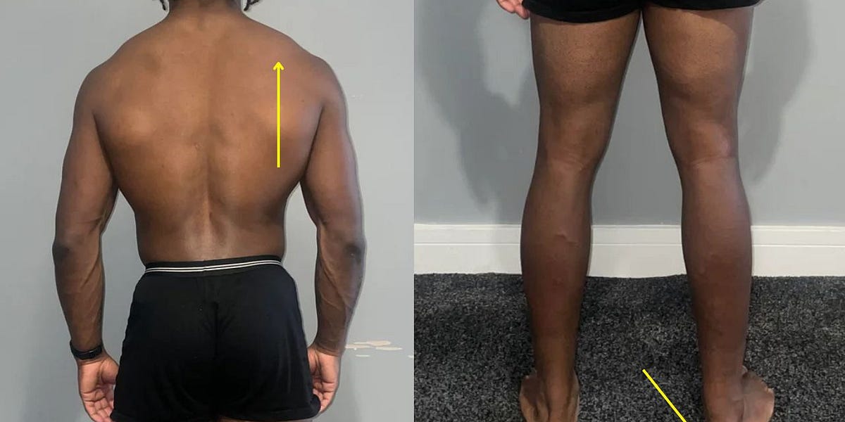 Why One Shoulder Sits Lower Than the Other (And How to Fix It)