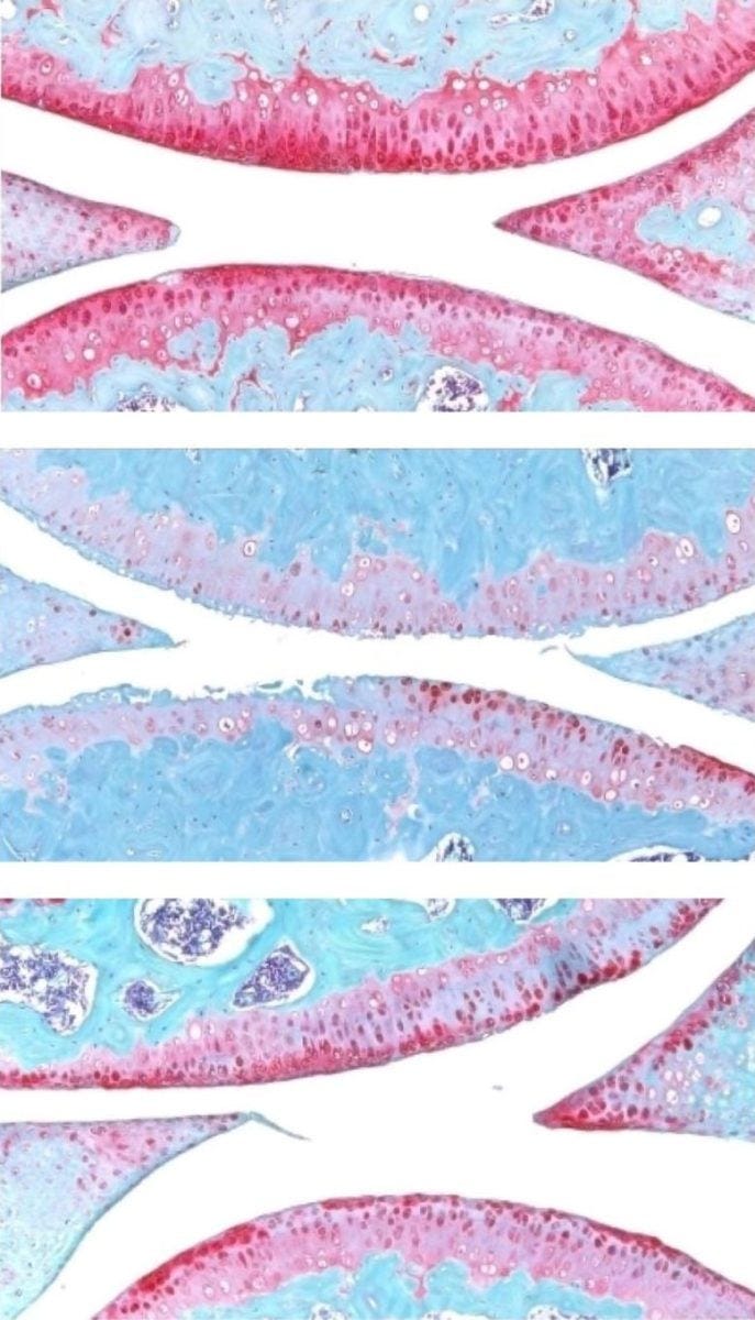 Joint Cartilage Regeneration is Real!