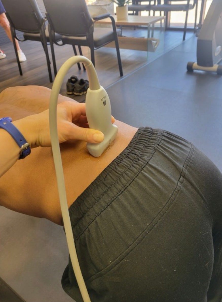 Inside the Isometric Contraction: Fascicle Shortening, Tendon Strain ...