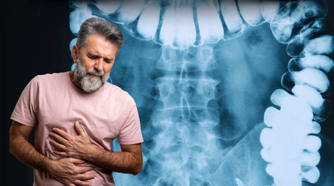 Obstrução intestinal: o que é, sintomas, causas e tratamento