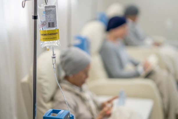 Chemotherapy! The Bad & the UGLY Side Effects - by Survivor