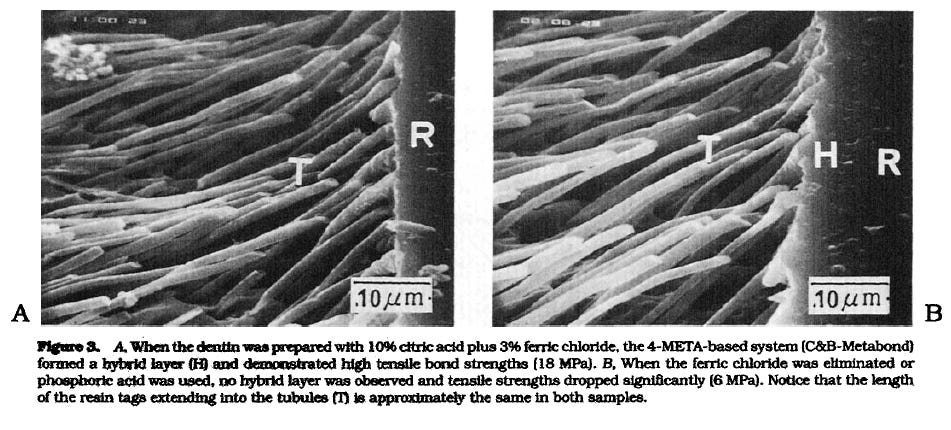 Hybrid Layer as a Dentin‑Bonding Mechanism - by Alex Besmer