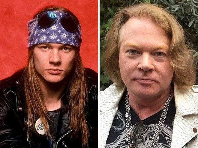 What happened to Axel Rose?