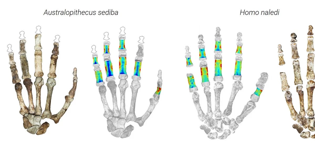 hand bones structure