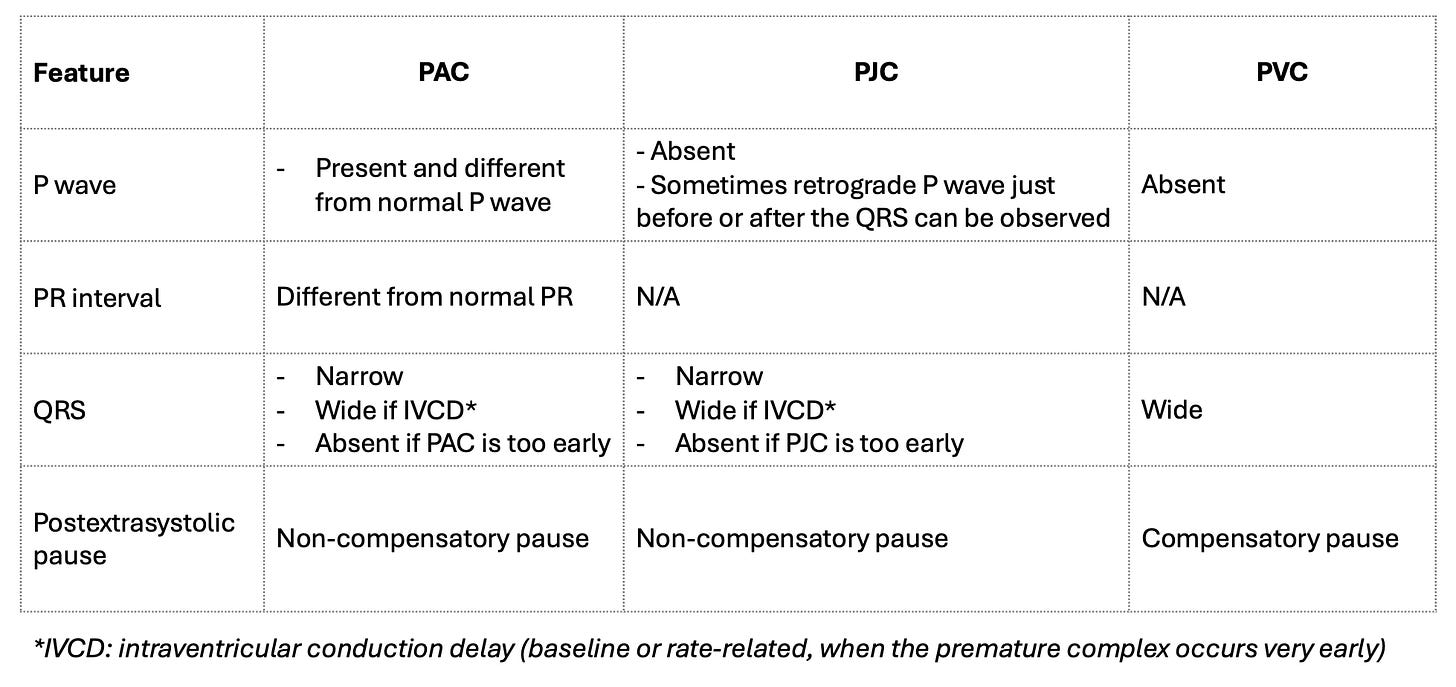 Premature complexes: atrial vs junctional vs ventricular