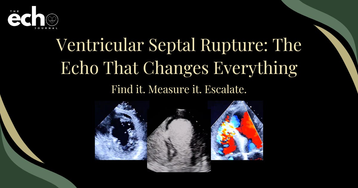 Ventricular Septal Rupture: The Echo That Changes Everything
