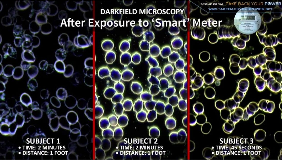 Wireless Radiation & Frequencies Cause Blood Clotting Within Two ...