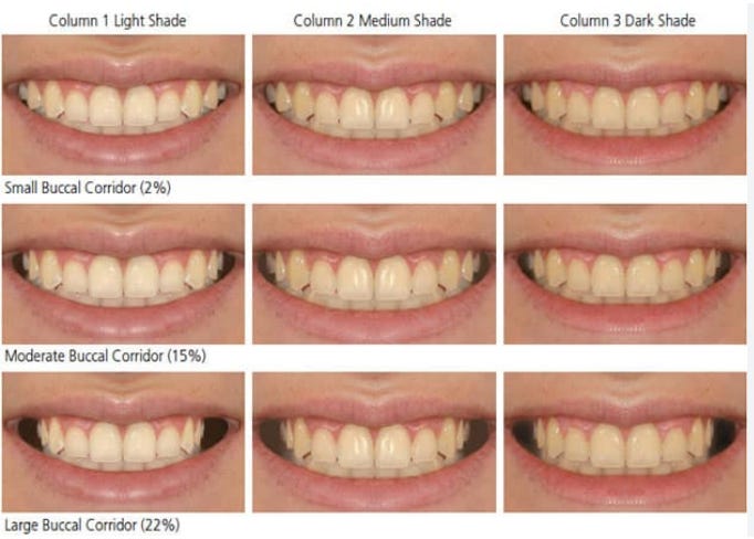 Beauty + Health Part 1: The Maxilla