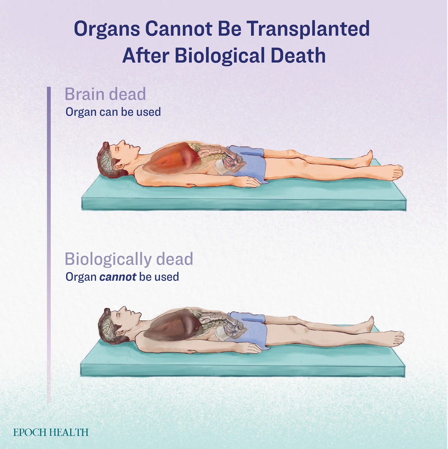 Brain Dead People May Not Be Dead–Here’s Why