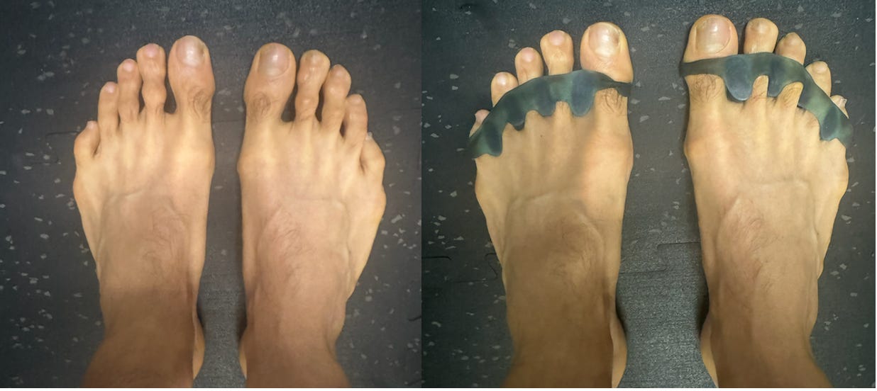Toe Spacers? The Case for Foot Health in Longevity