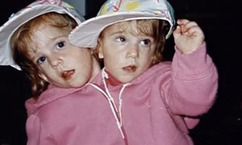 Conjoined Twins and Collectivism - by Holly MathNerd