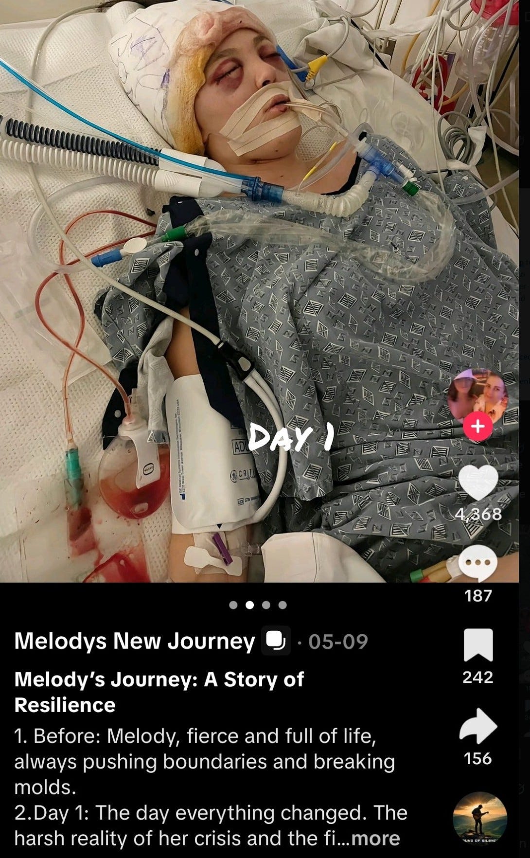 What happened to Melody Dawson? - by Exulansic