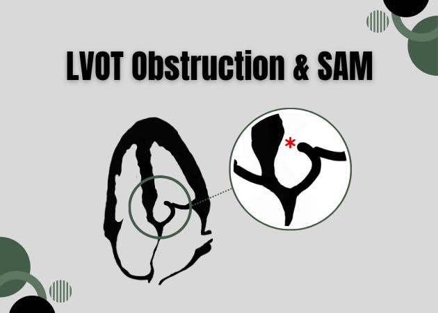Mastering LVOT Obstruction Assessment: A Step-by-Step Approach