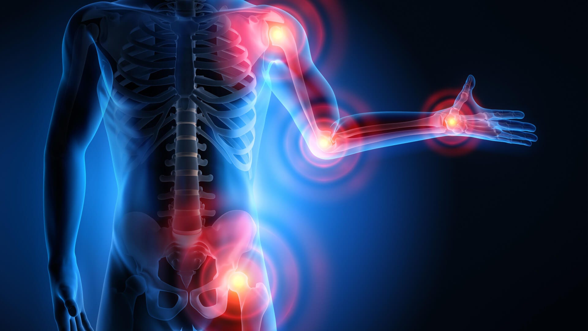 Inflammation - by Kenneth Hemmler
