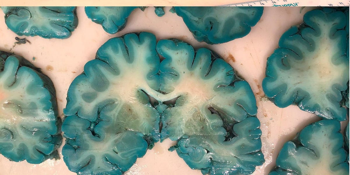 The Blue Brain Effect: Methylene Blue’s Dark Side & What You Should Be ...