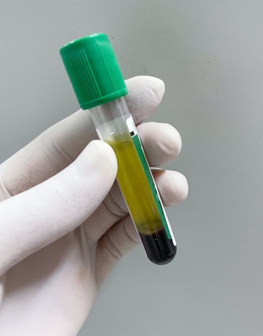 The Order of Draw Series: Part Four - Heparin Tubes