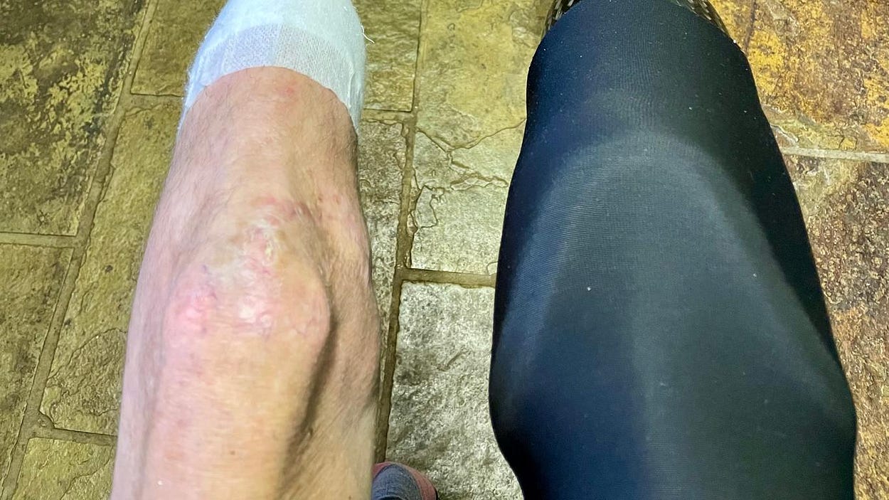 tom staniford condition