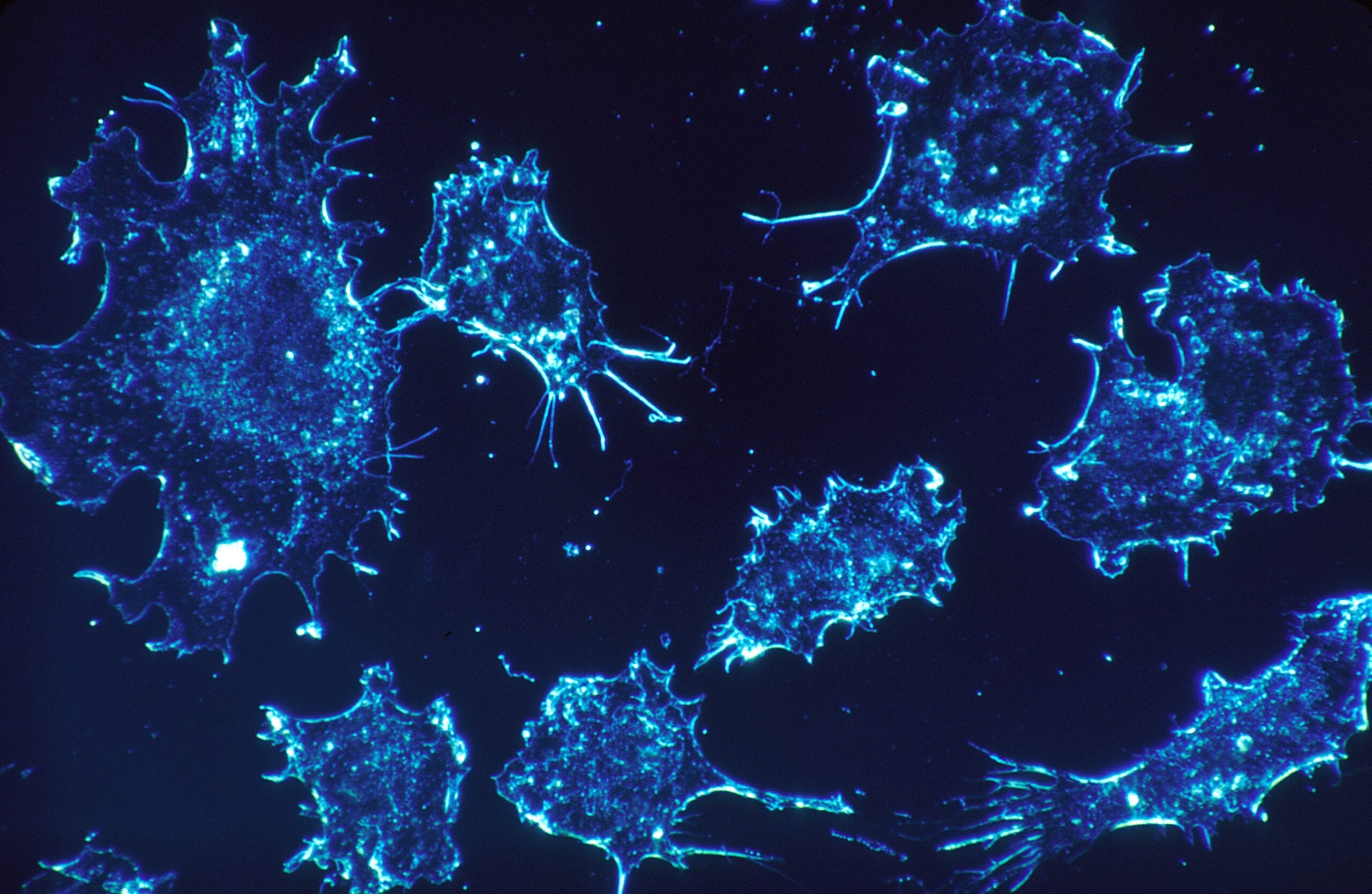 What NIH Layoffs Mean for Cancer Patients
