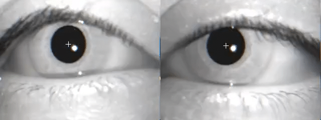 The Saccade Explained: Decoding the Eye Movements You See at the Bedside