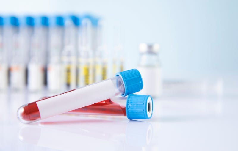 The Order of Draw Series (Deep Dive): Part Two - Sodium Citrate Tubes