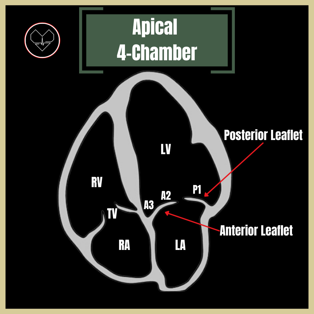 Mitral Valve Leaflets Diagram