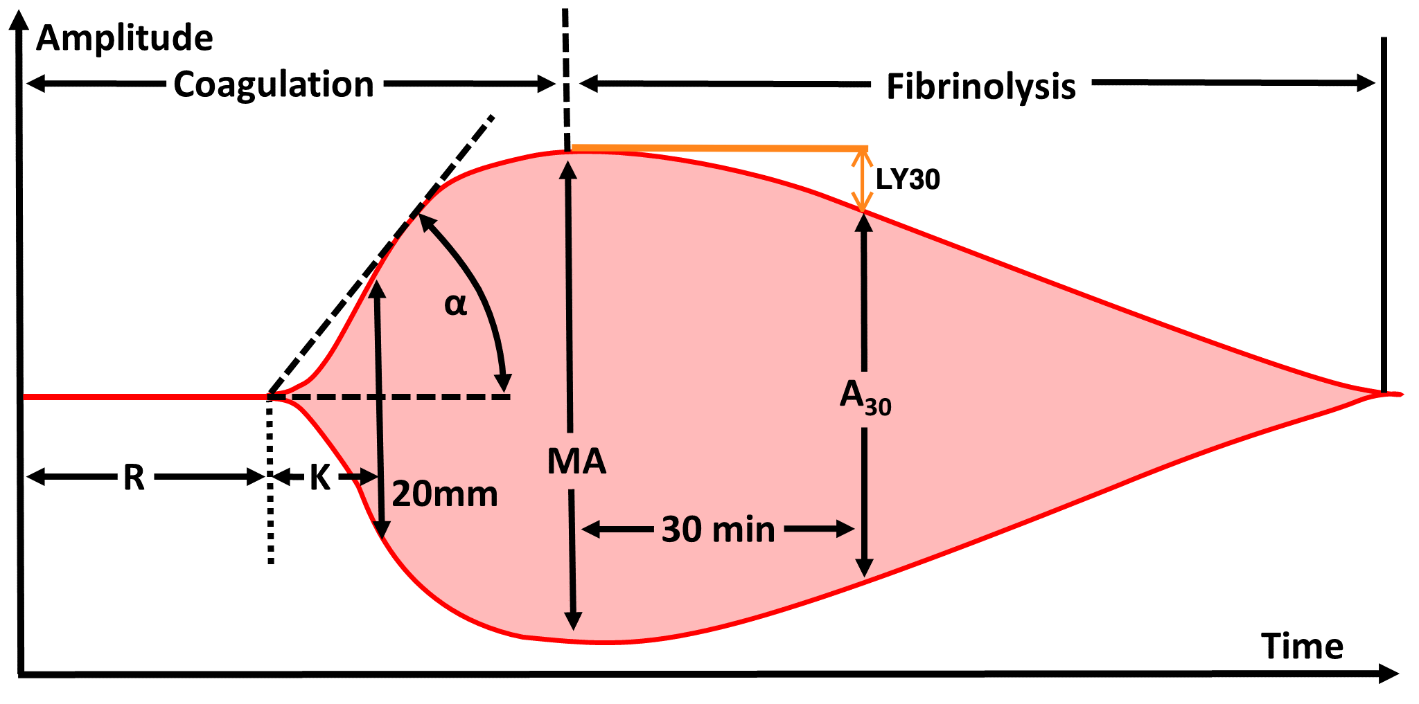 Thromboelastography (TEG, ROTEM™, etc) for bleeding: Review (Part 1 ...