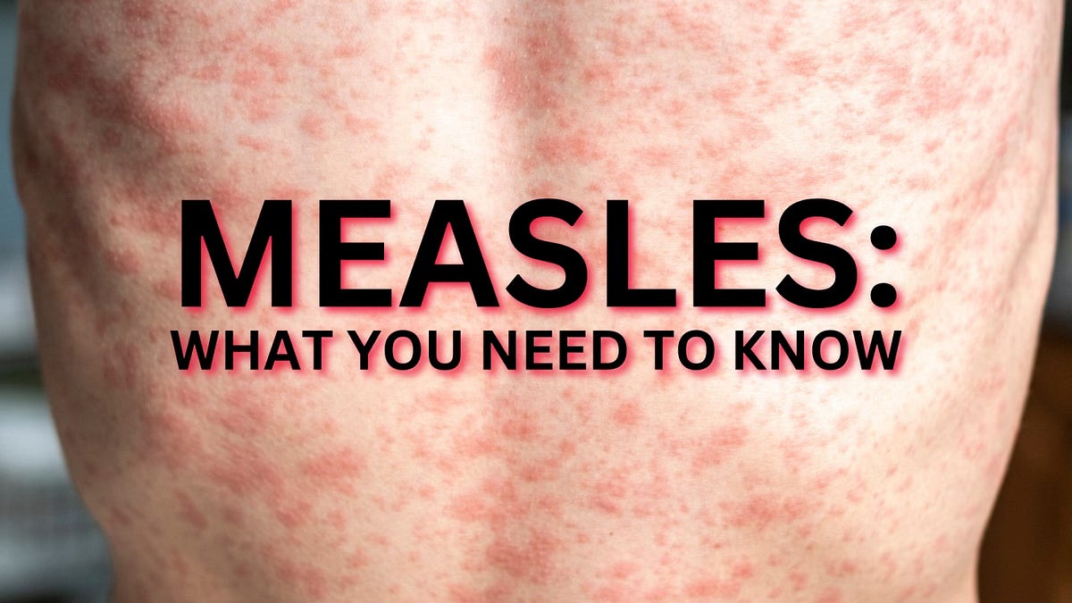 You Read the Measles Article. Now Let’s Answer the Hard Questions.