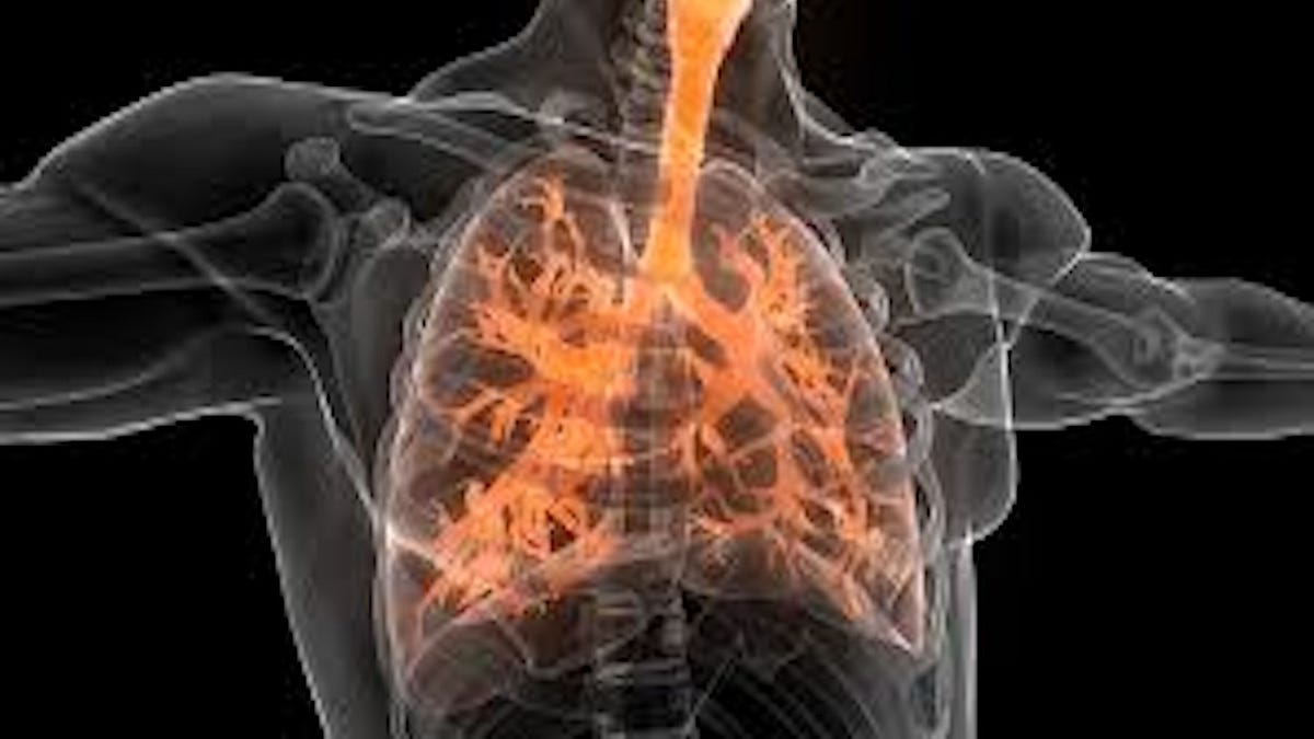 Air Traffic Related Air Pollution (ATRAP)