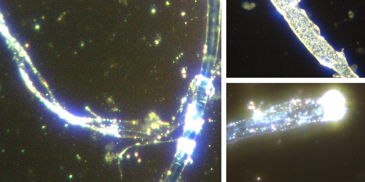 Darkfield Microscopy of Canine Distemper - Adenovirus Parainfluenza ...