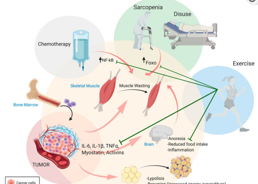 Cachexia: Standard-of-cancer-care induced starvation, potential simple ...