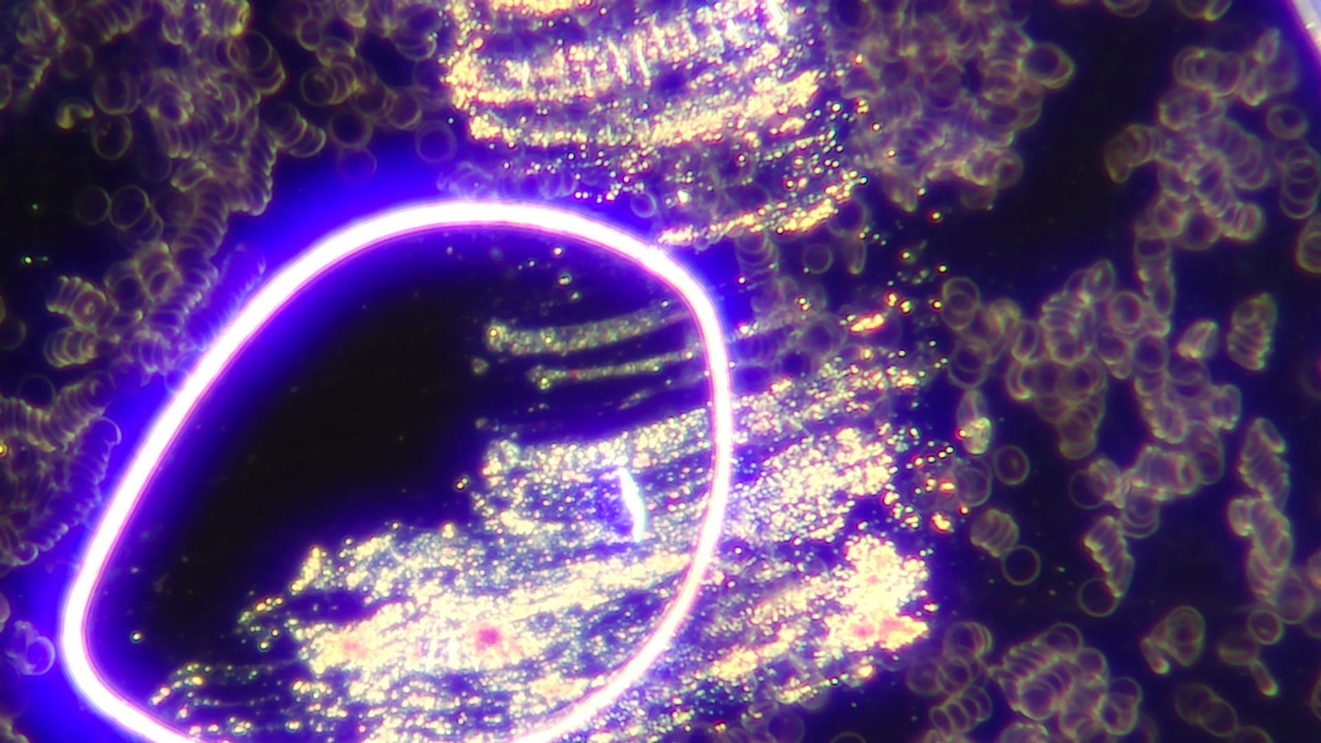 Interesting Microscopy Finding on Film Day in the New Clinic
