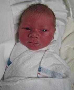 Pediatric Pearls: Infant's Skin Part 1 - Color Variations