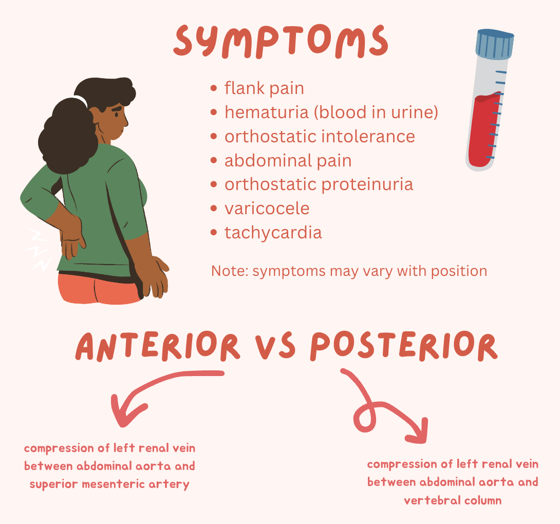 Nutcracker Syndrome - by Cortney Gensemer, PhD