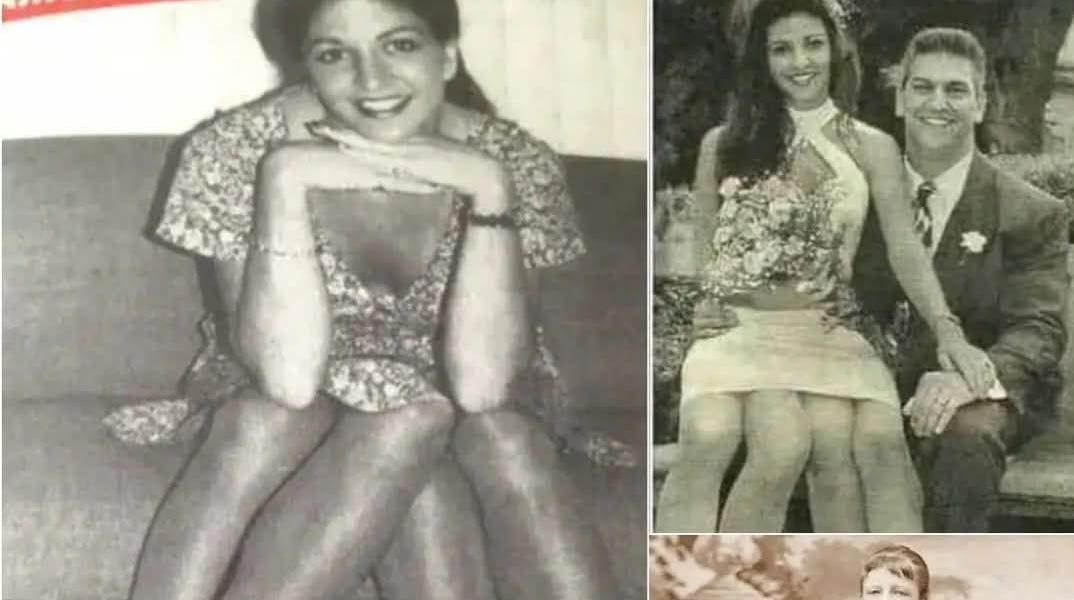 The Astonishing Life of Josephine Myrtle Corbin: The Four-Legged Woman ...