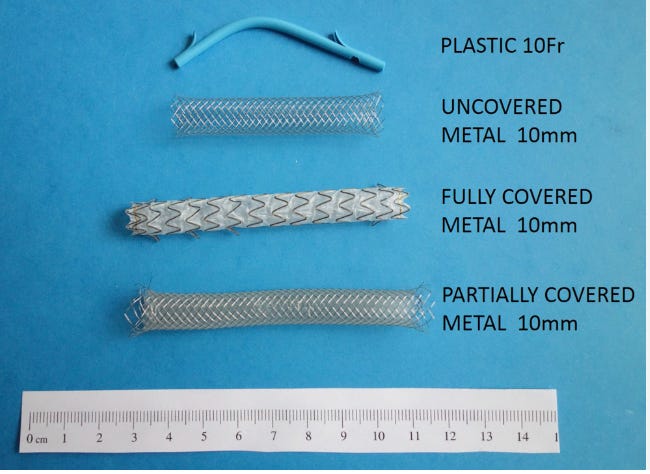ERCP Explained: Why It's Done and What to Expect