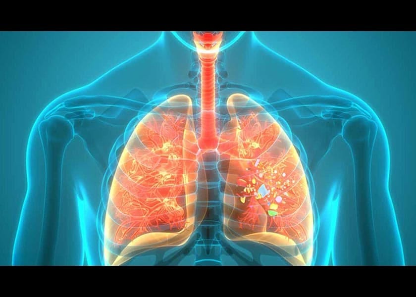 Microplastics Found to Trigger Cancer-Linked Changes in Lung Cells